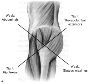 Your Guide to Good Posture: Tips and Exercises | D'Connect