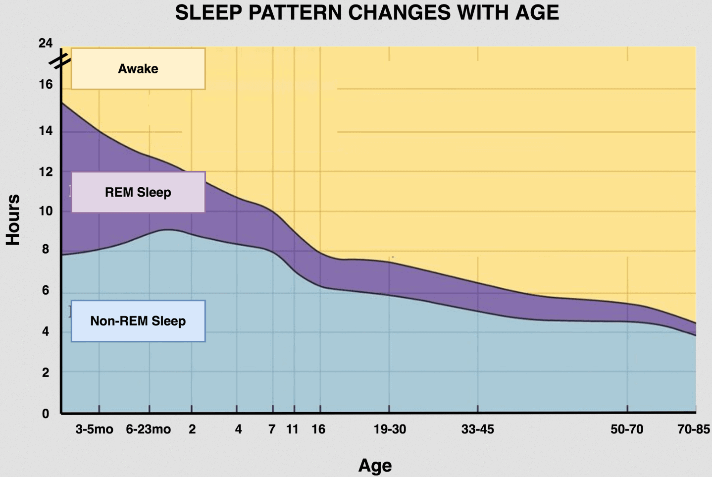 Different types of sleep - which one do we need the most? | D'Connect